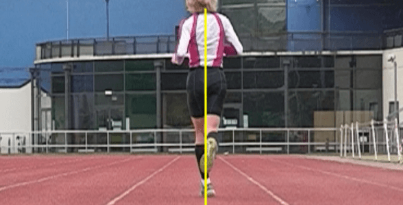 ITB Syndrome Rehab: Running Step Width Modification | Kinetic ...
